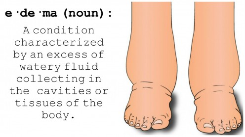 Information on Diseases, Illnesses & Conditions | HealthProAdvice