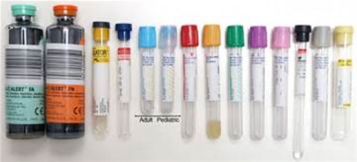 Order of the draw - Phlebotomy | hubpages