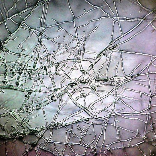 Treat and Prevent Mold and Mildew in Home and Cars - Natural Remedies ...